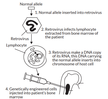 Give a schematic representation of gene therapy